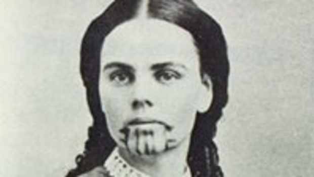 Inbred People Blue Skin