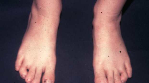 Kids Health - HubPages