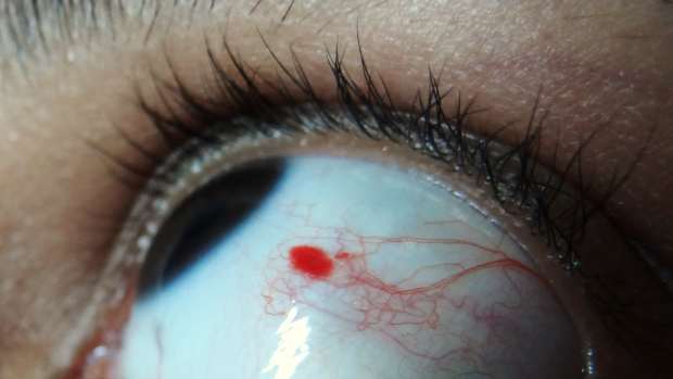 Eye Care Information & Advice - YouMeMindBody - Health & Wellness