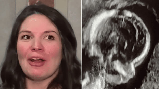 Alabama Mom Born With Ultra Rare Double Uterus Has One In A Million