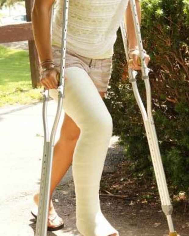 How I Learned to Live With a Broken Leg or Ankle Without Losing My Mind ...
