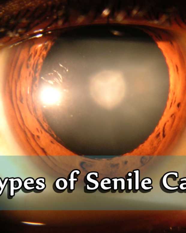 How to Read an Eyeglass Prescription - HealthProAdvice