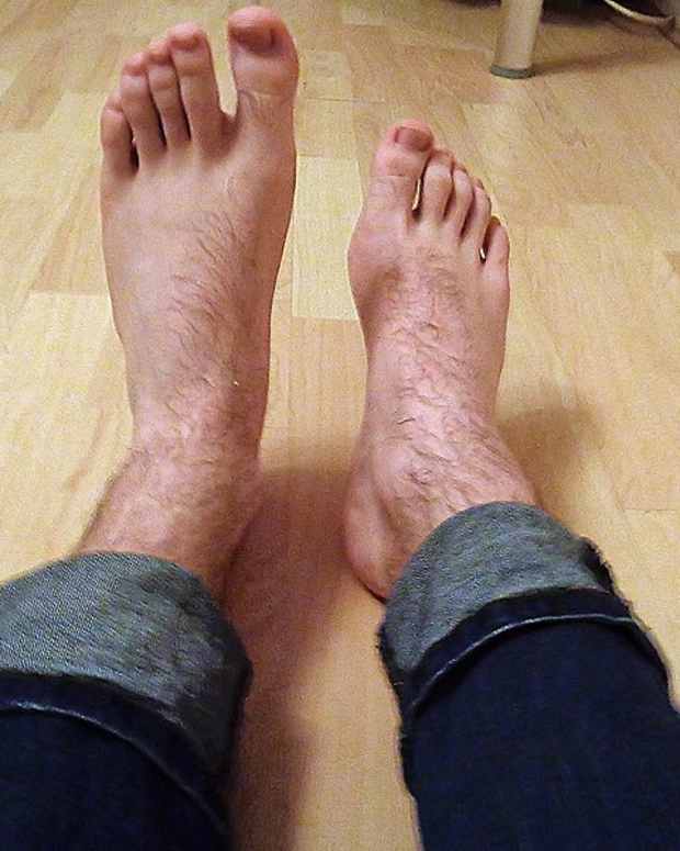 How I Learned to Live With a Broken Leg or Ankle Without Losing My Mind ...