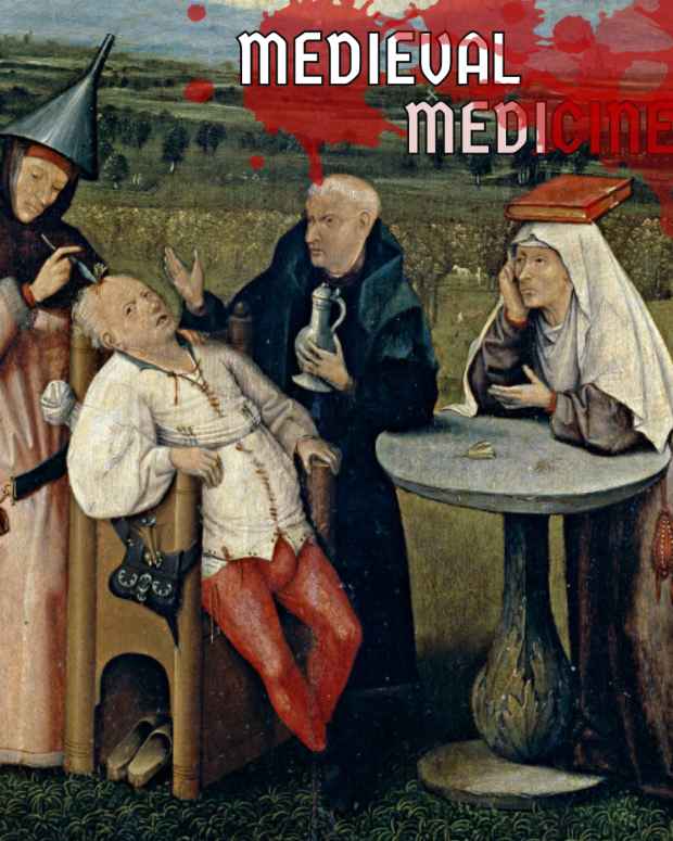 Unusual Weapons of Medieval Europe - Owlcation