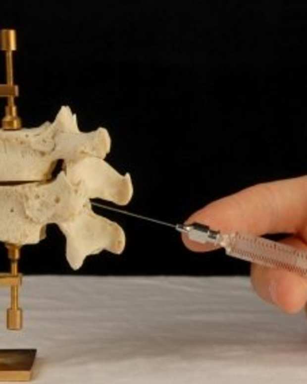 What You Should Know About a Spinal Anesthesia Block - HealthProAdvice ...