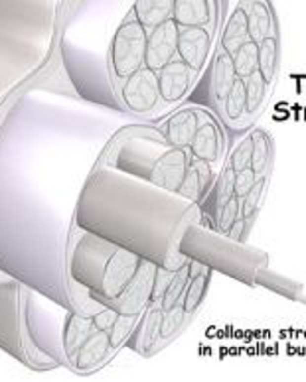 A Severed Flexor Tendon in the Pinky Finger: My Story - Patient's ...