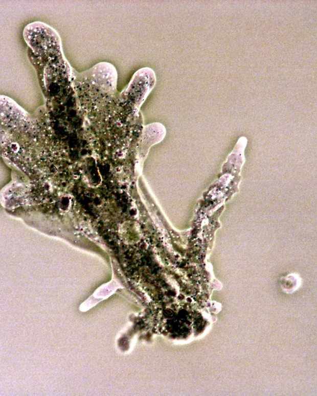 The Immune System, Lymphocytes, and NK, B, and T Cells - Owlcation ...