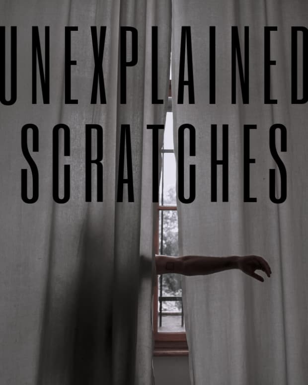 What Are These 3 Unexplained Scratches on My Body? (With Photos ...