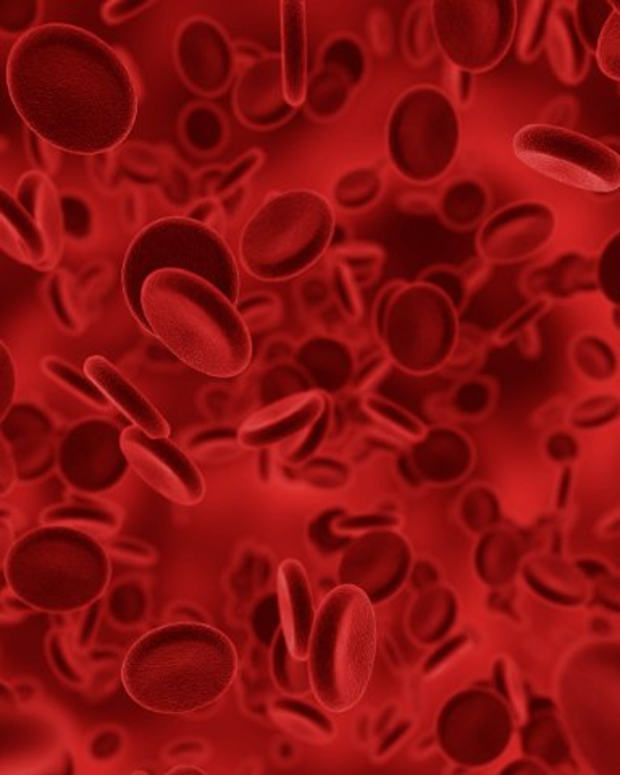 Which Doctors Treat Patients With Pulmonary Embolisms (Blood Clots in ...