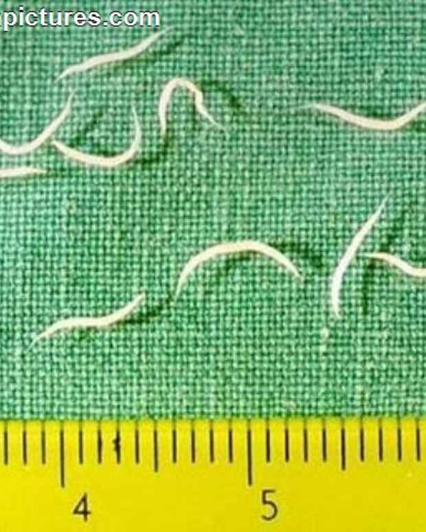 How to Get Rid of Scabies: 15 Steps That Worked for Us - Patient's Lounge