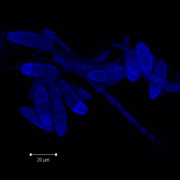 A Micrscopic Look at Ringworm - Owlcation