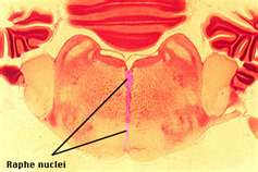 Serotonin's Role in Depression and How SSRIs Can Help - HubPages
