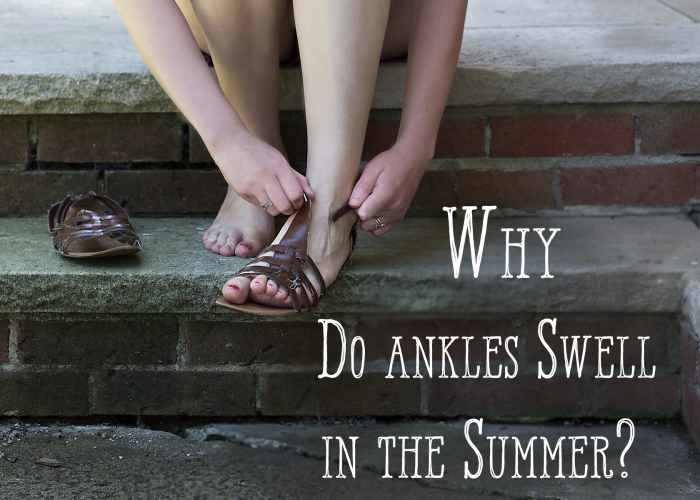 Why Do Ankles Swell in Hot Weather? Prevention and Treatment - HubPages
