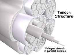 My Experience and Treatment for Tendinosis (Not Tendinitis) - Patient's ...