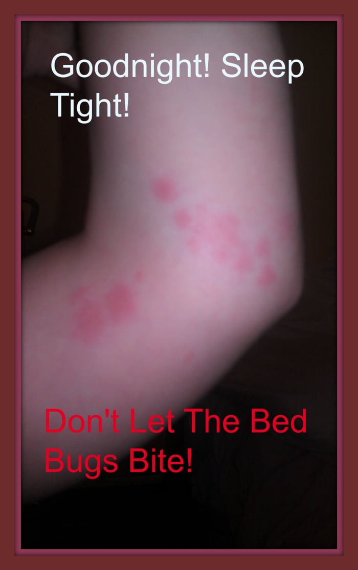 Bed Bug Removal Checklist Outline - Dengarden