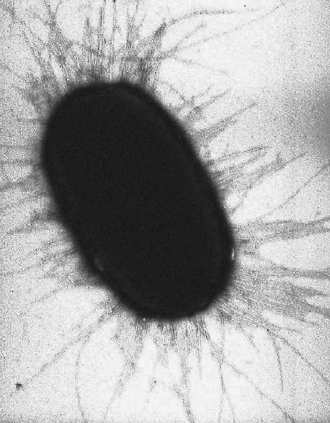 Escherichia or E. coli: Cell Facts, Gut Bacteria, and Infection - HubPages