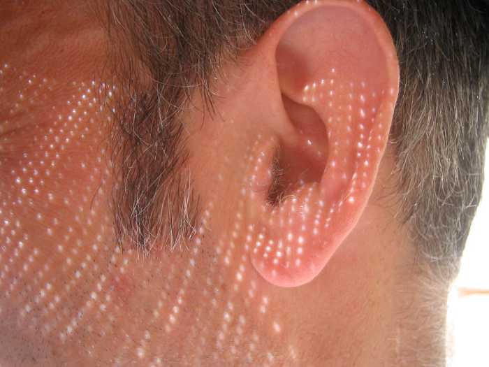 Musical Hallucinations: A Blessing and a Curse - HubPages