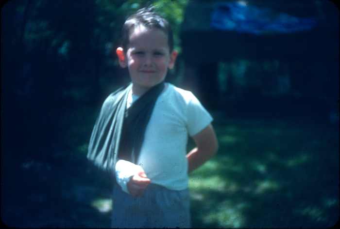 Recovering From Two Broken Wrists: My Story - Patient's Lounge