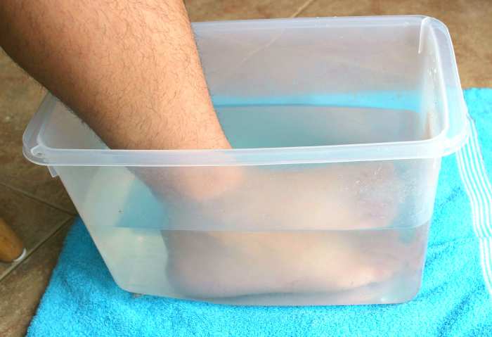 How to Treat a Cold Pack Burn - HubPages