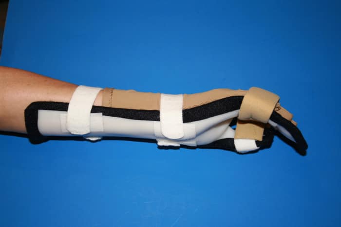 How to Relieve Arthritis Pain With Resting Hand Splints - HubPages