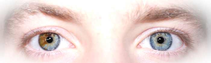 Heterochromia Iridum: People With Two Different Colored Eyes - HubPages