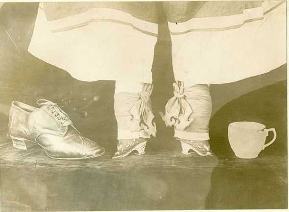Chinese Foot Binding - HubPages