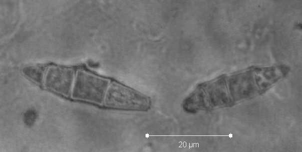 A Micrscopic Look at Ringworm - Owlcation