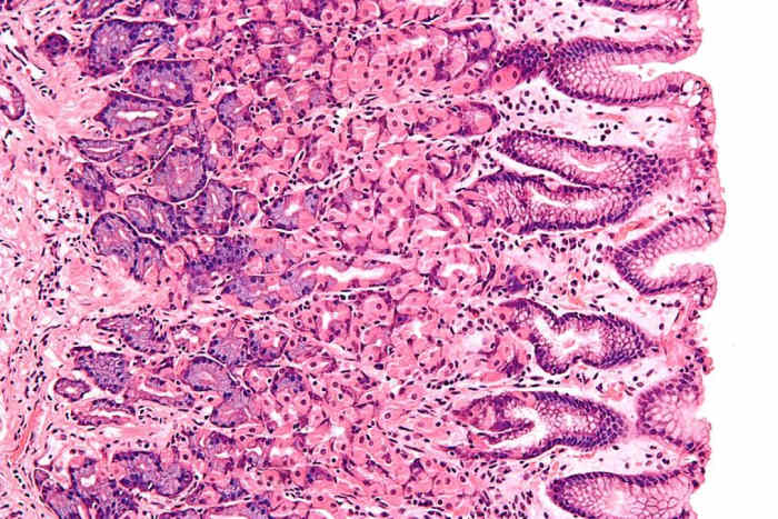 Hydrochloric Acid in the Stomach: Functions and Problems - Owlcation