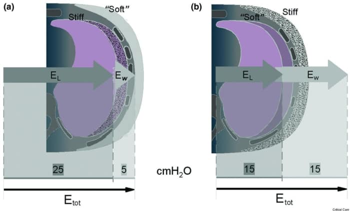 Lung Compliance and Elastance - Owlcation