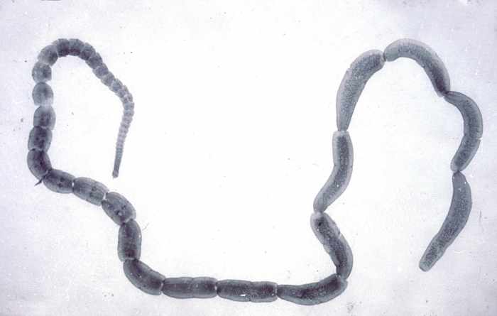 Intestinal Worms in Dogs: Symptoms and Treatment - PetHelpful