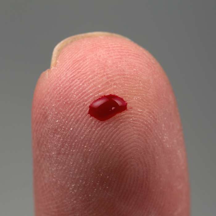 Blood Magic and What You Should Know When Practicing Witchcraft - HubPages