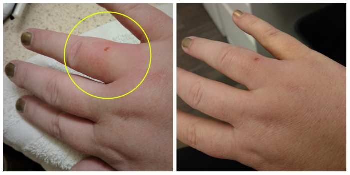 8 Photos People With Fibromyalgia Do Not Want Anyone to See - Patient's ...