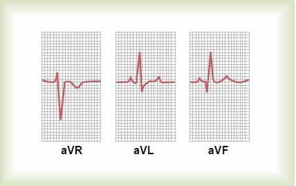 How to read a normal ECG(Electrocardiogram)? - HubPages