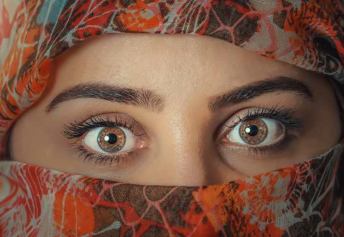 Stretch Marks on the Face: What You Need to Know - HubPages