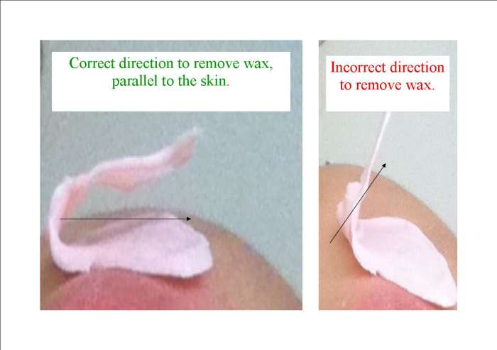 Waxing - how to wax your arm hair free like a pro. - HubPages