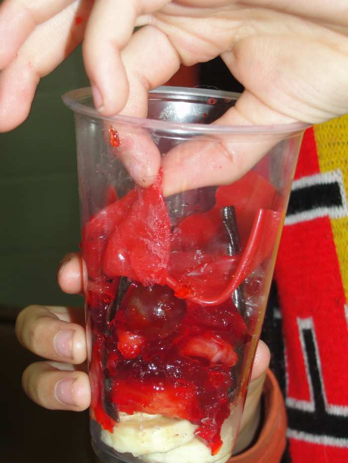 Immune System and Skin Lesson - HubPages