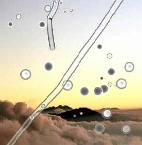 Floaters in the Eye: Causes, Symptoms and Treatment - HubPages