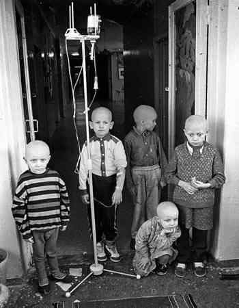 Seriously deformed children of Chernobyl - The story of the nuclear ...