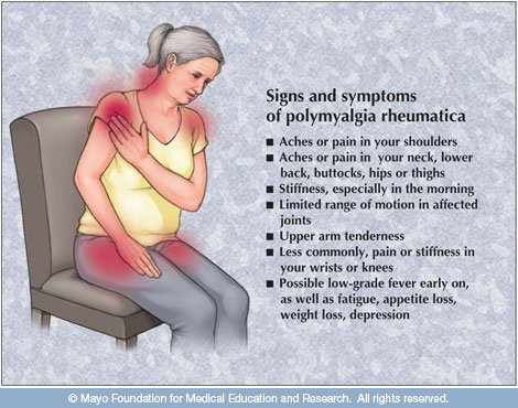 Polymyalgia Rheumatica What is it? - HubPages