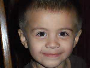 Allergy Shiners How To Cure Them... - HubPages