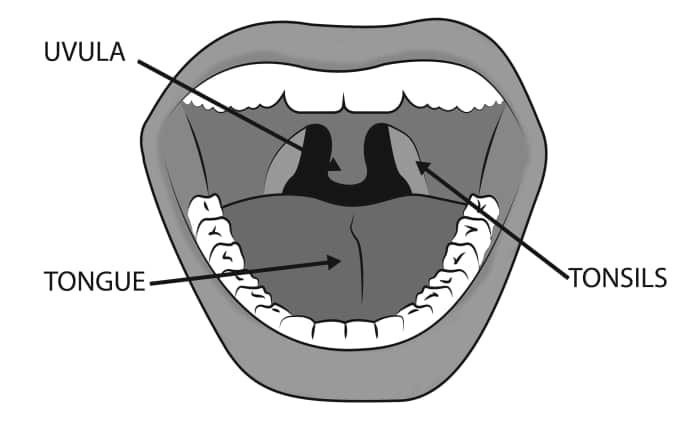 Swollen Uvula: Causes, Symptoms, Treatment and Remedies - HubPages