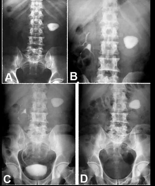 Instrumental Methods of Examination, X-rays and Radioisotopic ...