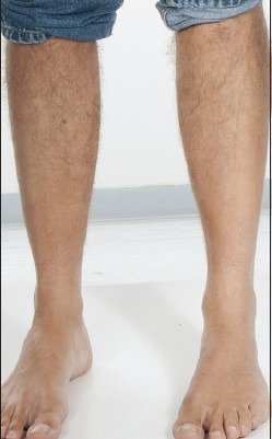 Leg Hair Loss in Men? It's Not Uncommon. - HubPages