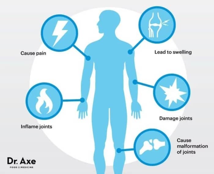 Is Your Joint Popping a Bad Thing? a Physical Therapist's Insight ...