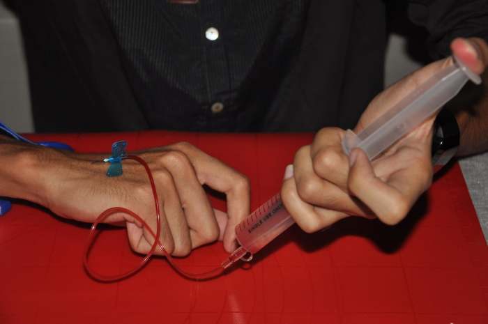 Differences between Hemophilia and Thalassemia - HubPages