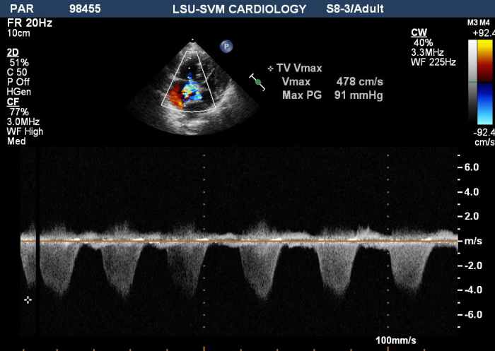 What To Expect From An Echocardiogram - HubPages