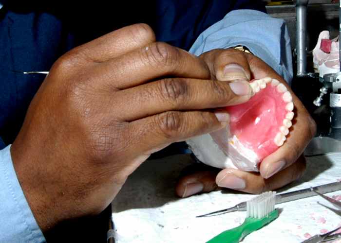 What to Expect When Getting Dentures for the First Time: My Experience ...