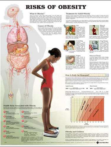 Risk of Obesity Charts and Posters - HubPages