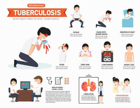 Tuberculosis and its types - HubPages