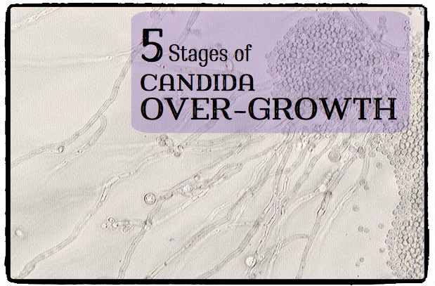 The 5 Stages of Candida Overgrowth - HubPages